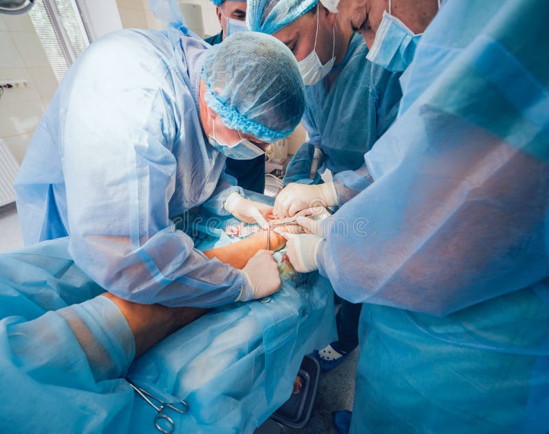 Process of Trauma Surgery Operation. Group of Surgeons in Operating ...