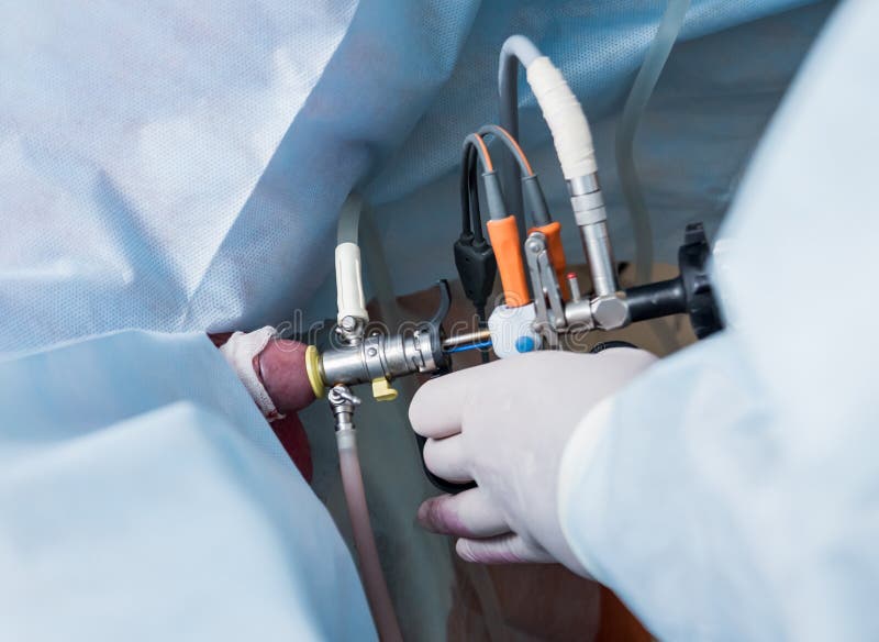 Process of Urological Surgery Operation Using Laparoscopic Equipment ...