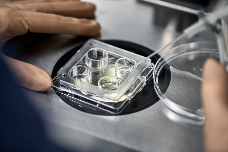 Process of in Vitro Fertilization in Laboratory Stock Image - Image of ...