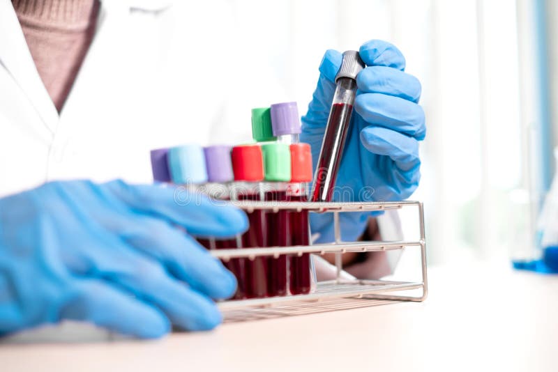 Professional Doctors Perform Find Virus Tests from Samples of Blood ...