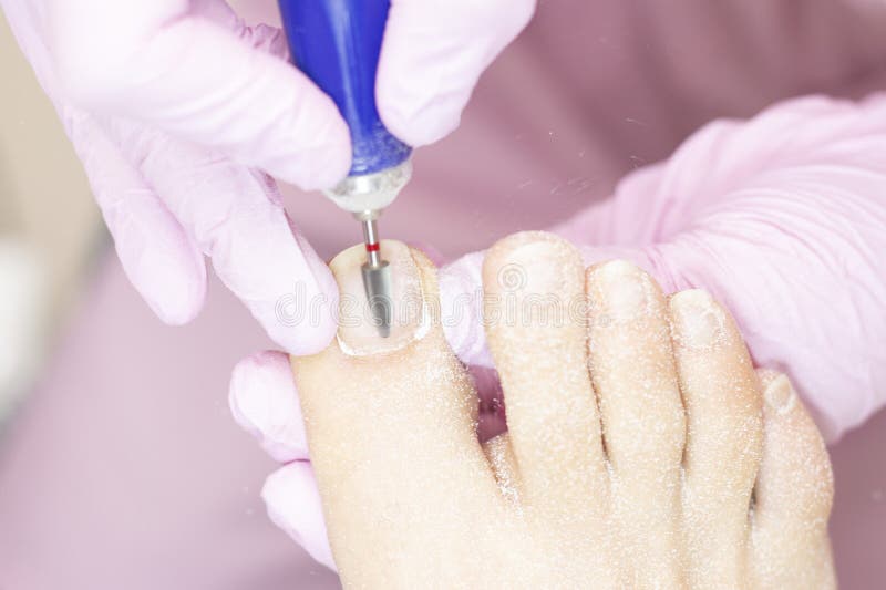 Professional Hardware Pedicure Using an Electric Machine. Patient at ...