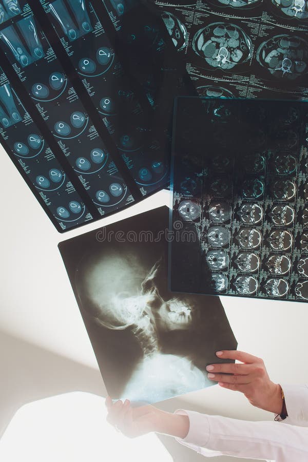 Professional Medical Team Examining Patient's Medical Records and X-ray ...