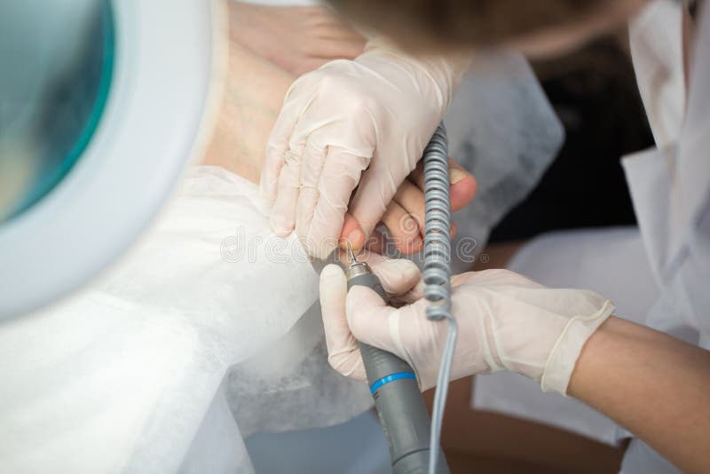 Podiatry Procedure with Pedicure Machine. Care of the Feet. Stock Image ... Podiatry Procedure with Pedicure Machine. Care of the Feet. Stock Image ...