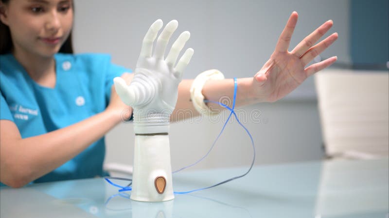 Technician Testing Robotic Bionic Arm at Prosthetic Manufacturing Stock ...