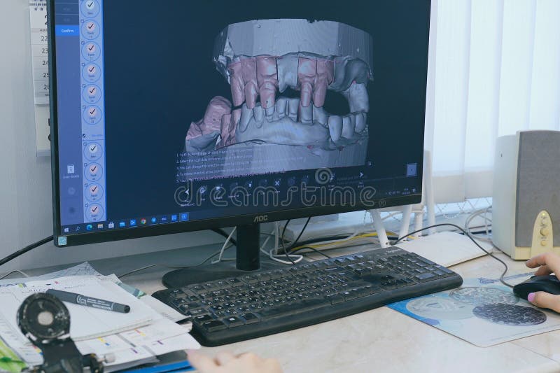 A Dental Technician Uses Software To Design Dentures. Editorial Image ...