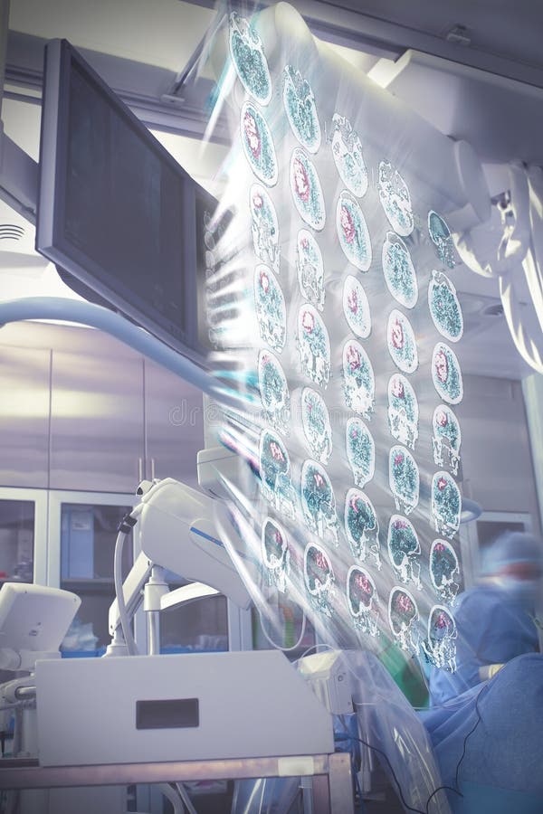 Projection of Head Examination in the Operating Theatre Stock Image ...
