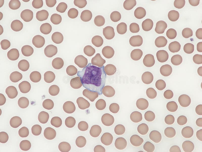 Prominent Nucleoli Stock Photos - Free & Royalty-Free Stock Photos from ...