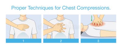 Emergency First Aid Cpr Step Step Procedure Stock Illustrations – 20 ...