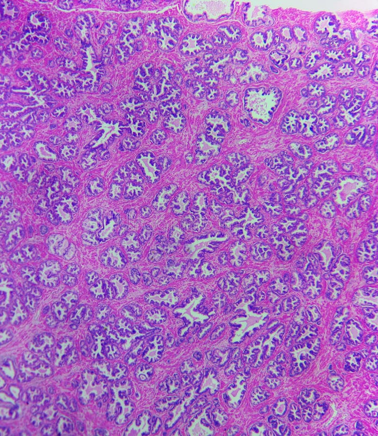 Prostaat Weefsel Jonge Mens Stock Foto - Image of kanker, geneeskunde ...