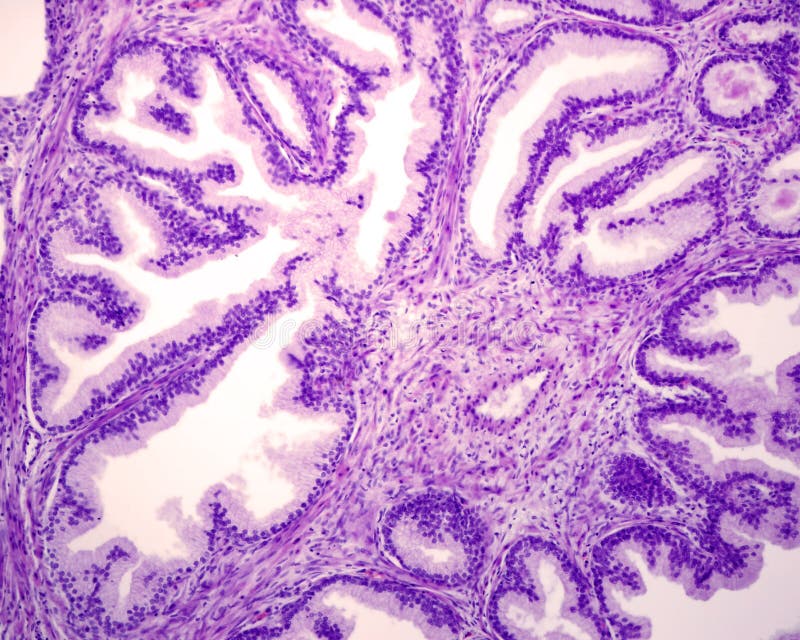 Prostate glands stock image. Image of epithelium, microscope - 344793065