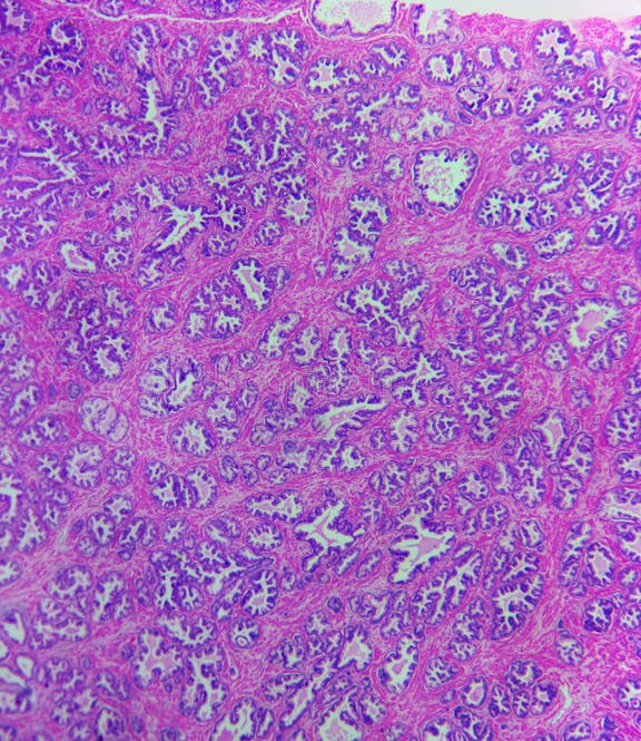 Prostatic Tissue Young Human Stock Photo - Image of microscope ...