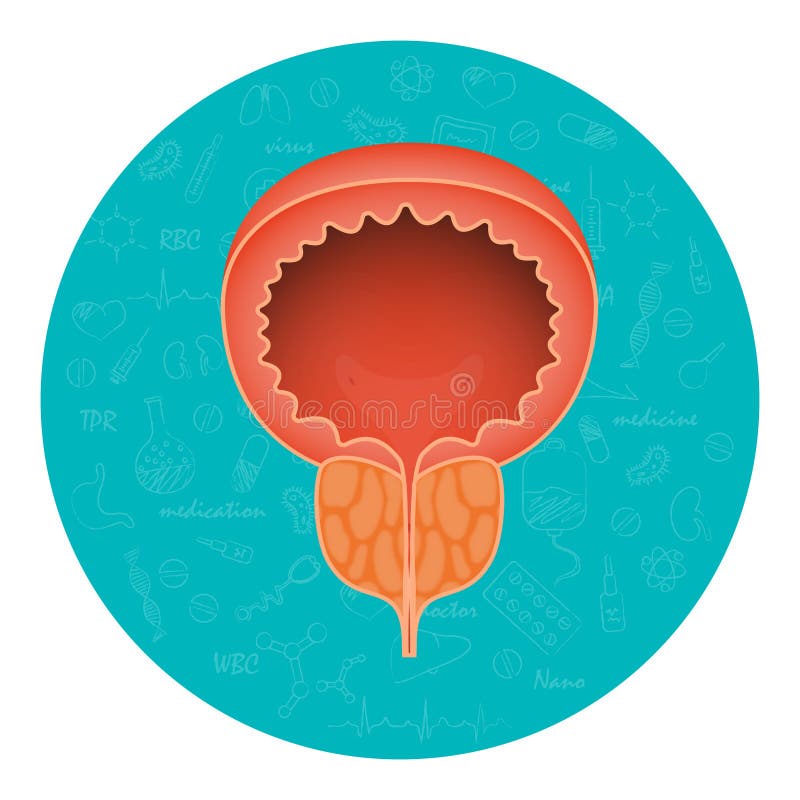 Prostatitis Hiperplasia Prost?tica Elementos Y S?mbolos Determinados M?dicos De Infographic Para ...
