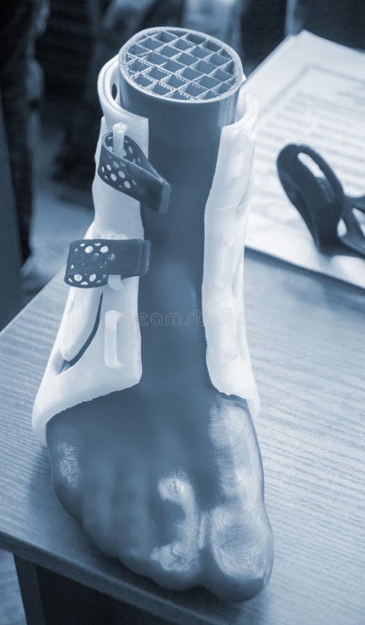 Prosthesis Printed 3D Printer from Molten Plastic Plastic Foot ...