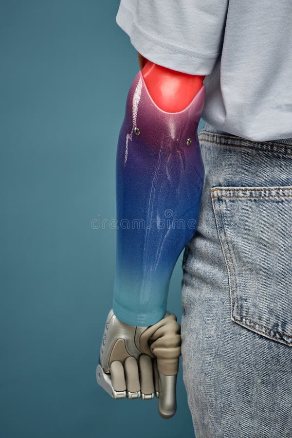 Prosthetic Hand Clenching Fist Stock Photo - Image of joint, studio ...