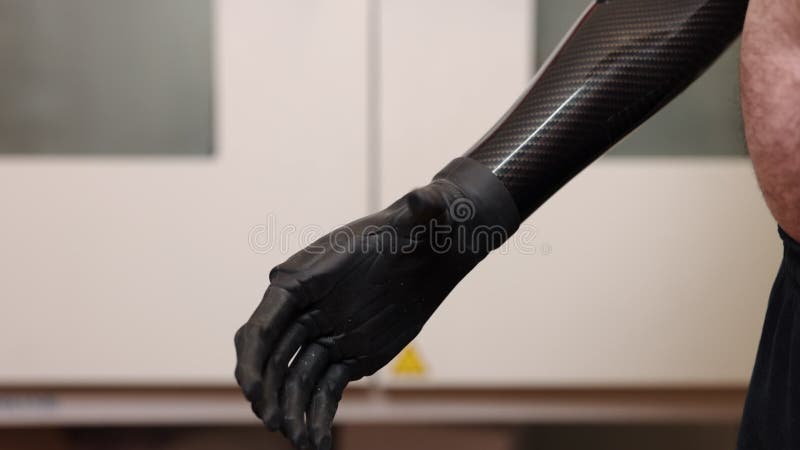 Prosthetic Hand, Hand Gripping, Prosthetic Control Stock Footage ...