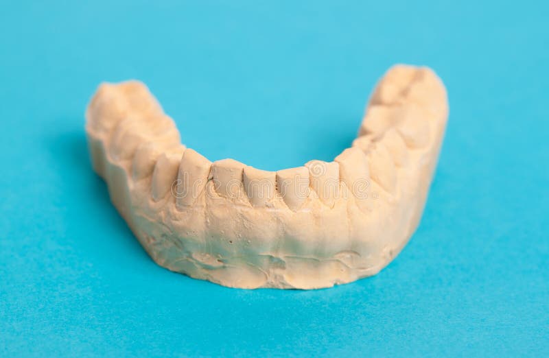 Prosthetic jaw stock image. Image of medicine, teeth - 50675365