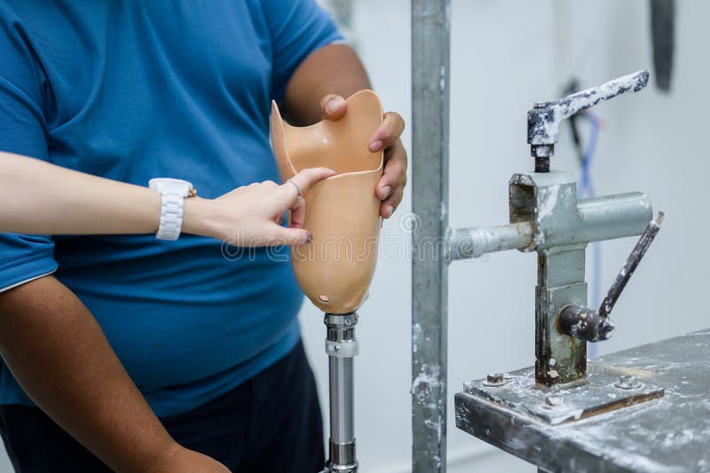Prosthetic Technician Holding Prosthetic Leg Checking and Controlling ...