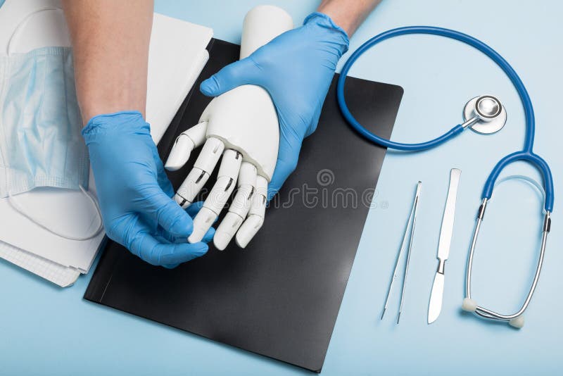 Prosthetics Hands at Doctor in Clinic. Artificial Limb Stock Photo ...