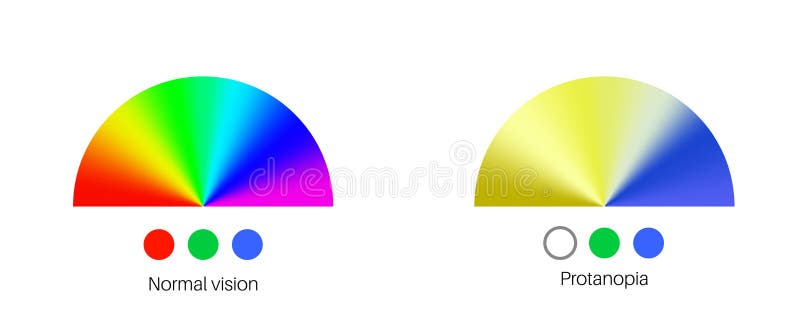 Protanomaly and protanopia stock vector. Illustration of vision - 307074935