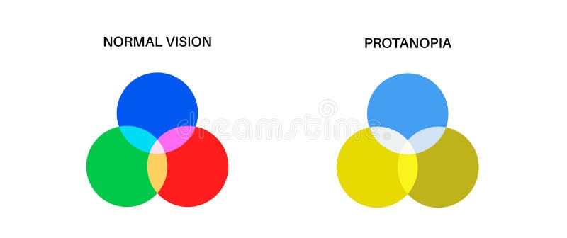 Protanomaly and protanopia stock vector. Illustration of dichromacy ...