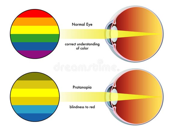 Protanopia stock vector. Illustration of optic, perception - 27568119