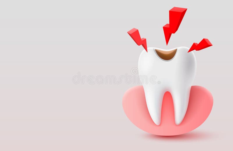 Protection of Teeth, Treatment Against Viruses and Caries. Vector ...