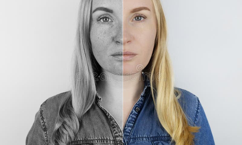 Ultraviolet Rays on Skin. Protective Creams Test. on the Left, the Skin ...