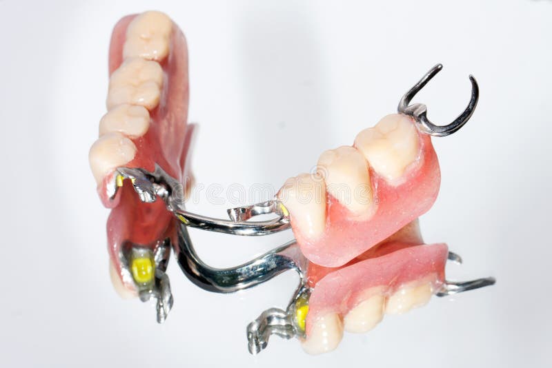 Prothèse Partielle Dentaire Image stock - Image du médical, sain: 41065619