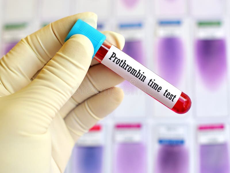 Prothrombin time test stock photo. Image of laboratory - 65172544
