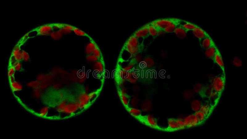 A Fluorescent Microscopy Image Showing the Glowing Green Conidia ...