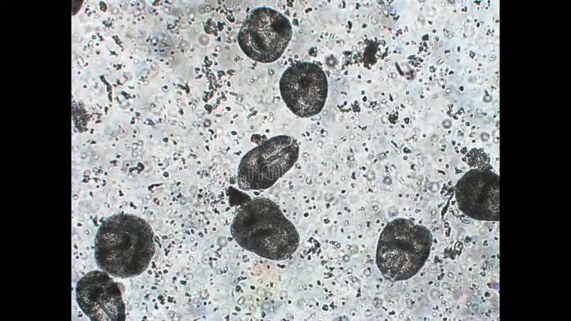 Protoscoleces of Parasitic Worm Echinococcus Multilocularis Twists ...