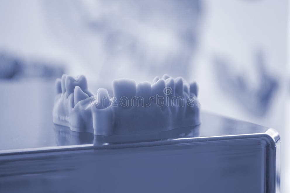 Prototype of Human Jaw Gums and Teeth Printed on 3D Printer from ...
