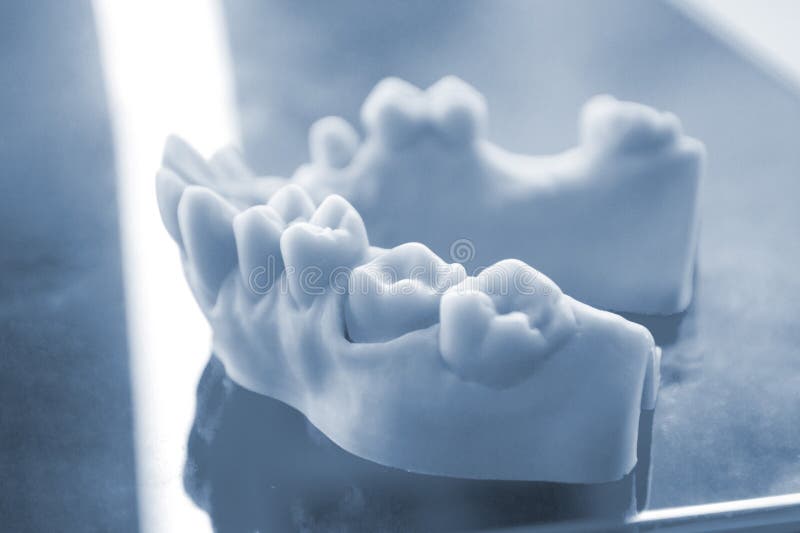 Prototype of Human Jaw Gums and Teeth Printed on 3D Printer from ...