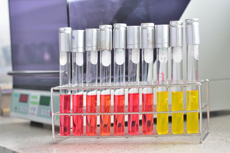 Prova Di Laboratorio Di Microbiologia Fotografia Stock - Immagine di ...