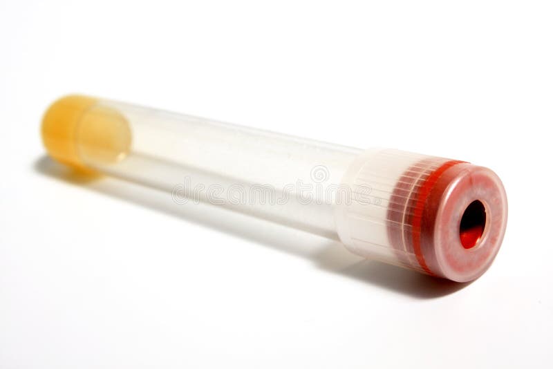 Provetta Con Sangue in Laboratorio Fotografia Stock - Immagine di ...
