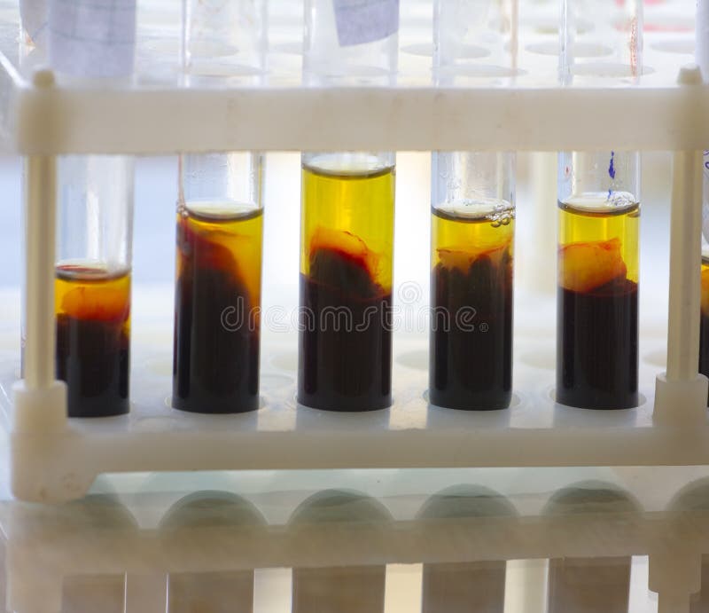 Sangue coagulato immagine stock. Immagine di ricerca - 64291691