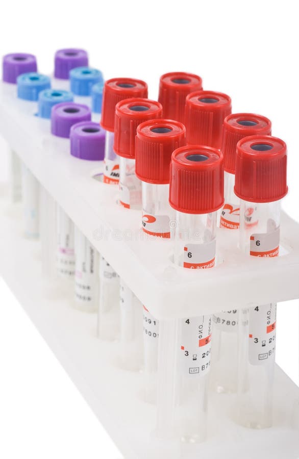 Provette fotografia stock. Immagine di diagnostico, gruppo - 8384500
