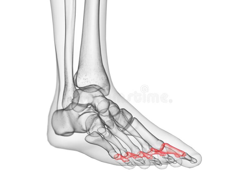 The proximal phalanx bones stock illustration. Illustration of proximal ... The proximal phalanx bones stock illustration. Illustration of proximal ...