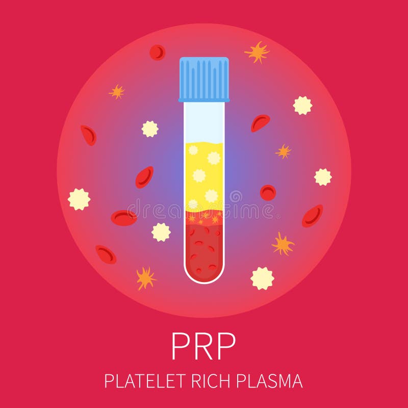 Prp Method Stock Illustrations – 150 Prp Method Stock Illustrations ...