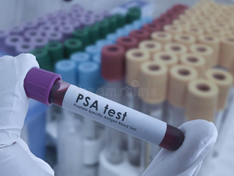 PSA blood test stock photo. Image of male, prostate - 226244012