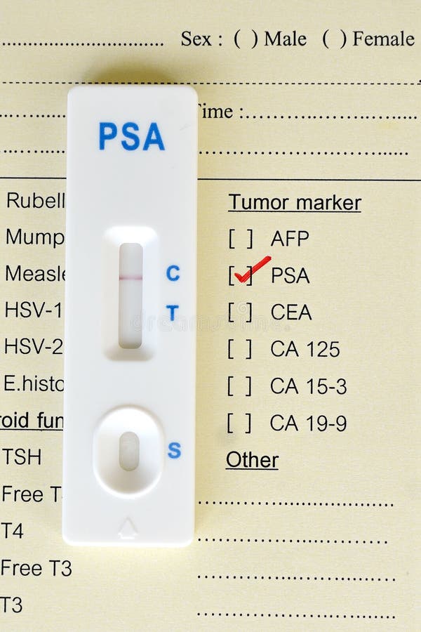 PSA negative stock photo. Image of patient, research - 56071324