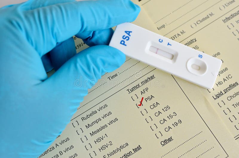 PSA negative stock image. Image of healthcare, hospital - 56071453