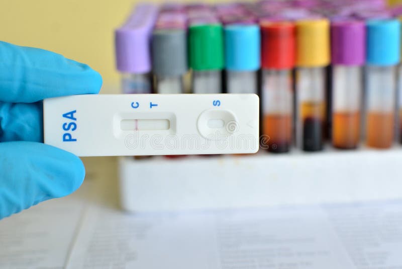 PSA negative stock image. Image of immunology, analyzing - 56316573