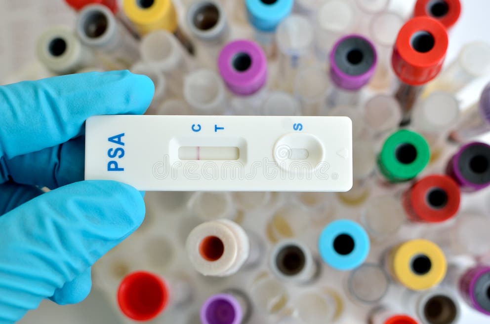 PSA negative stock photo. Image of hematology, scientific - 56317704