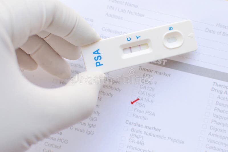 PSA positive stock photo. Image of negative, technology - 54767488