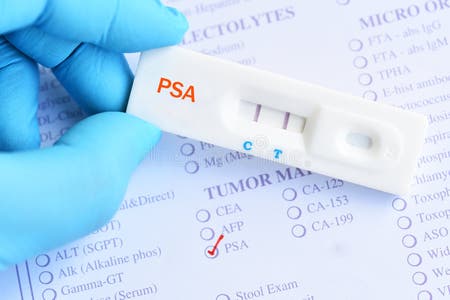 PSA positive test result stock image. Image of medical - 138652527