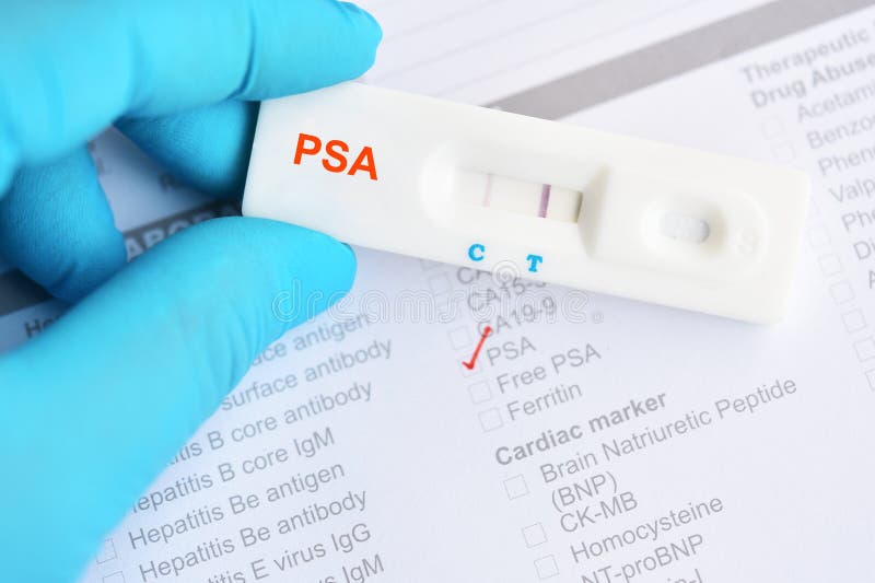 PSA positive test result stock photo. Image of aged - 155588112