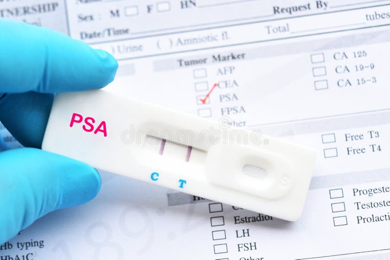 109 Psa Test Stock Photos - Free & Royalty-Free Stock Photos from ...