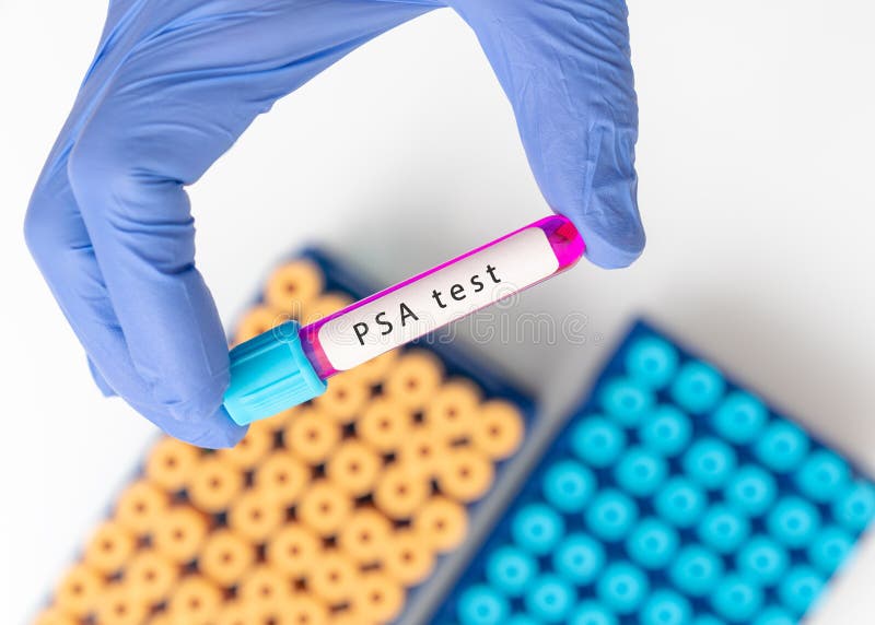 PSA Test Result with Blood Sample Tube Stock Photo - Image of chemistry ...