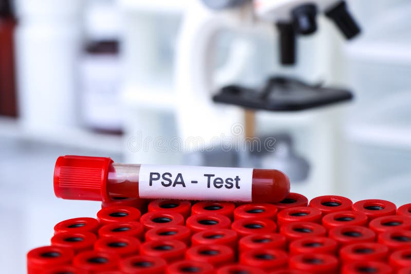 PSA Test To Look for Abnormalities from Blood Stock Image - Image of ...